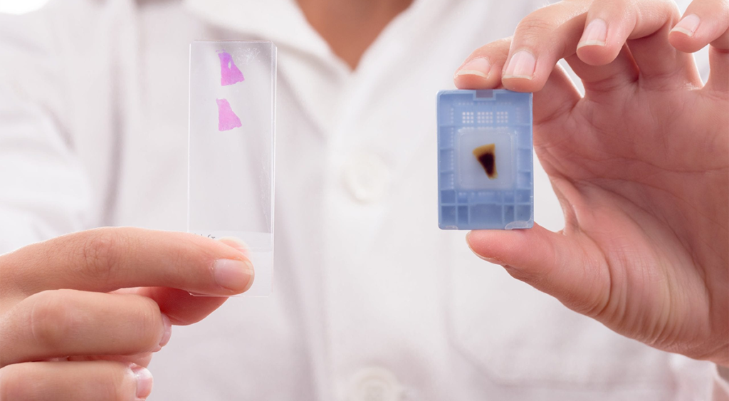 How Biospecimens Drive the Advancements of Biomedical Research?