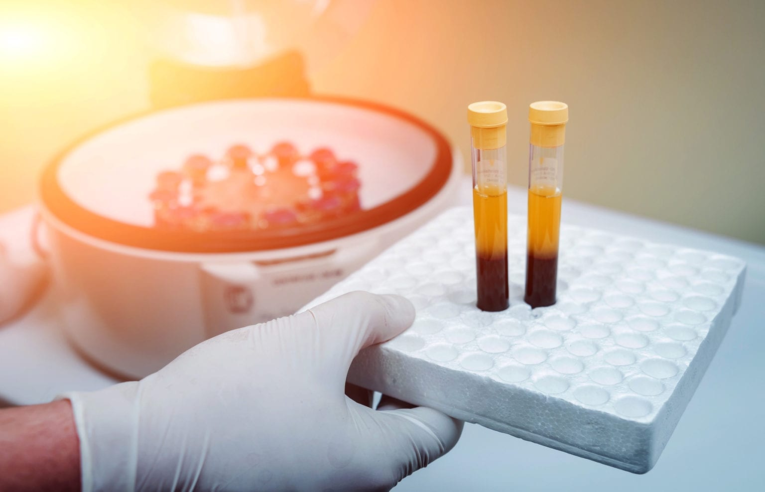 Handling Blood Samples - 5 Good Practices
