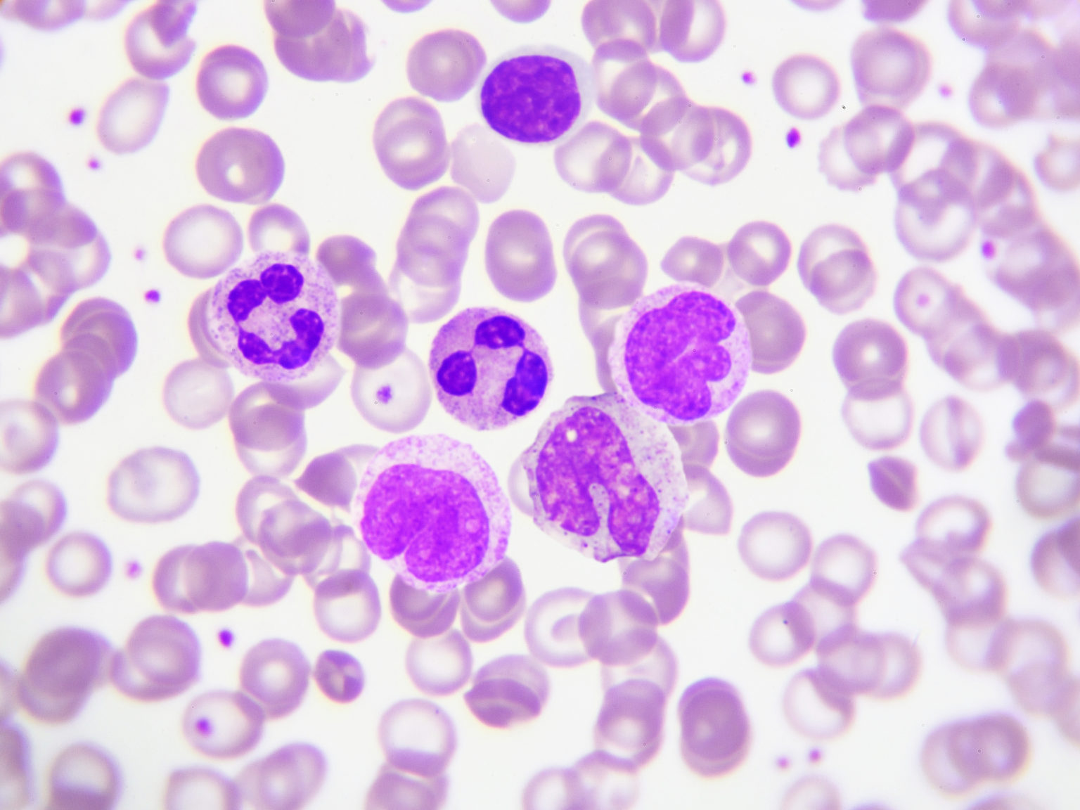 Peripheral Blood Processing - Discover The Universe Within a Blood Tube