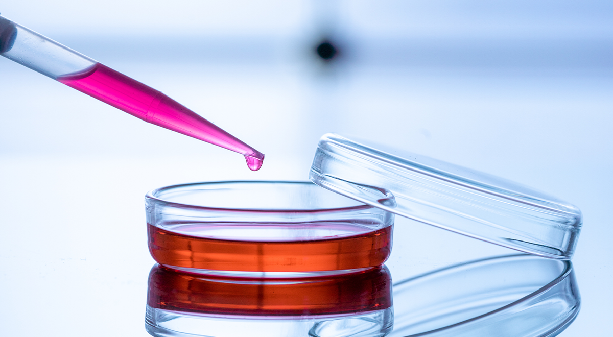 Cell Lines Versus Primary Cells as In Vitro Disease Models - An Overview